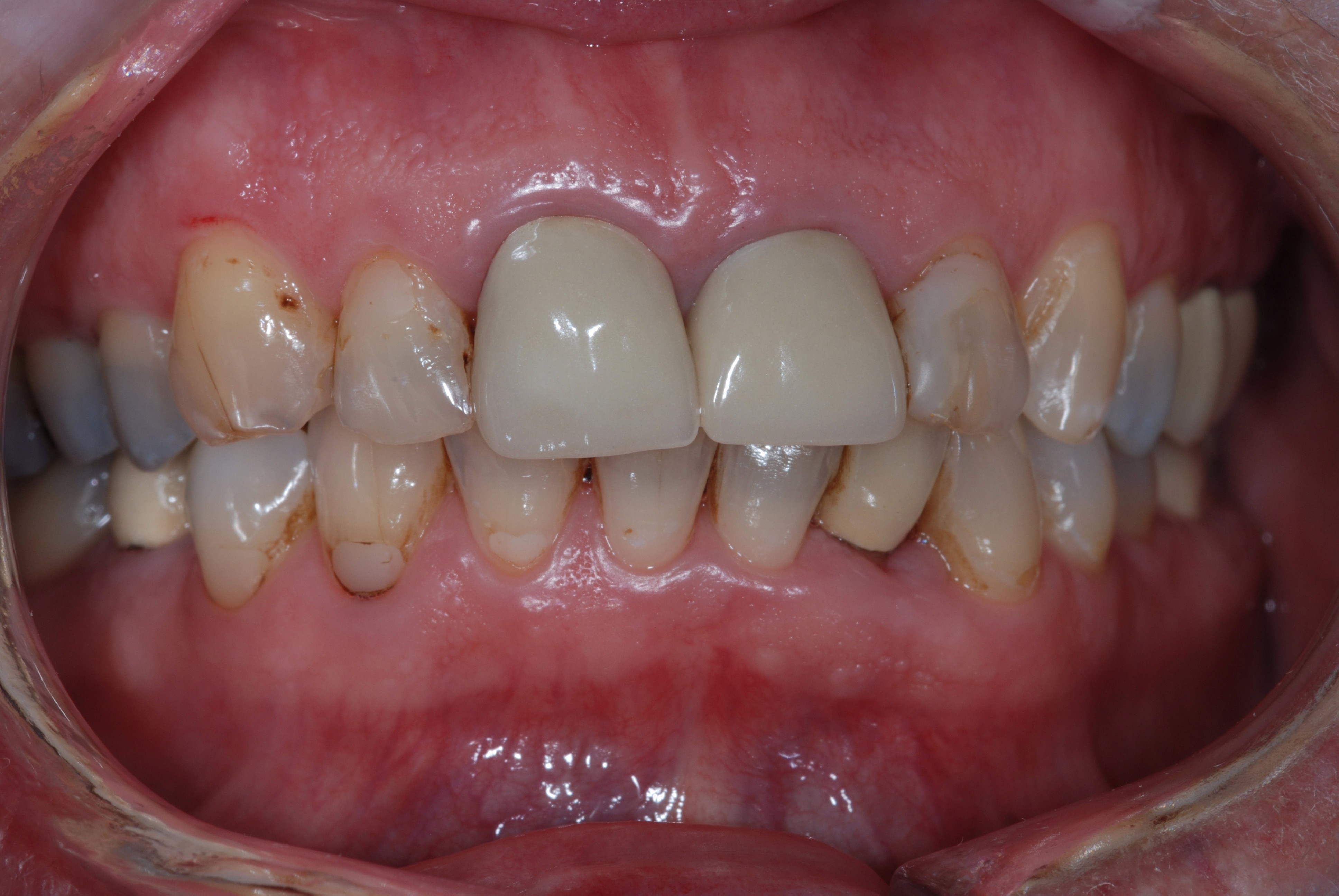 Optimal Clinical Practice for Treating Patients With Periodontal ...